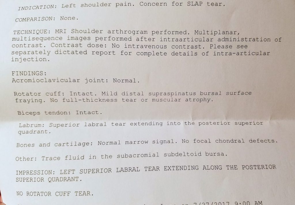 SLAP Tear – Surgery, Recovery, And Asking for Help – Given Eyes To See